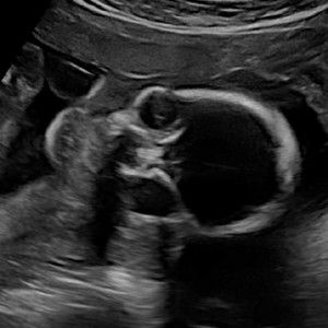 Baby Tino 🎀 - playlist by Jas Renee | Spotify