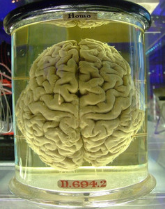 Grey Matter - by Zephyr Ash - Second Sound